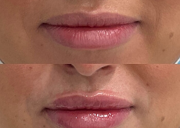 3 Best Cosmetic Clinics in Luton, UK - ThreeBestRated